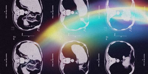 A New Ai Based Risk Prediction System Could Help Catch Deadly