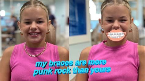 Reese Gets Braces The LeRoys YouTube