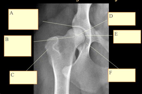 Sa Musculoskeletal Flashcards Quizlet