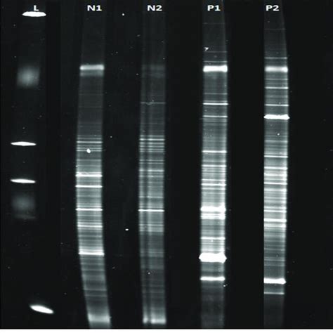 Comparison Of Dna Bands Separated By Density Gradient Gel Download