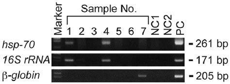 Pcr Detection Of M Leprae Dna From Skeletal Samples Pcr Analysis Was Download Scientific