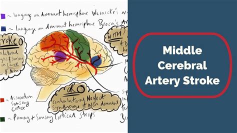 Cerebral Artery Model