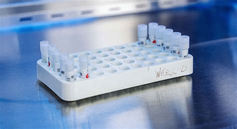 Interpreting Your Snp Microarray Results Wicell