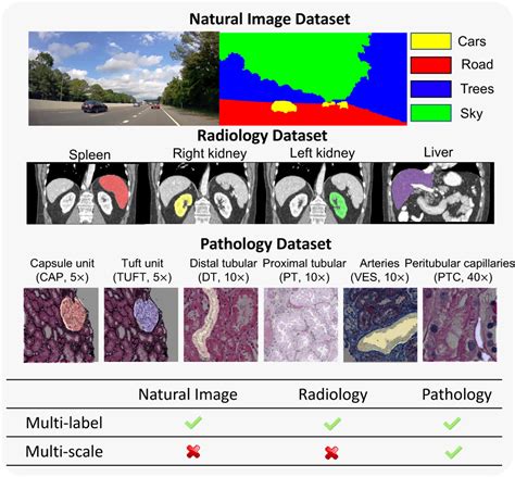 Omni Seg A Scale Aware Dynamic Network For Renal Pathological Image Segmentation Pmc