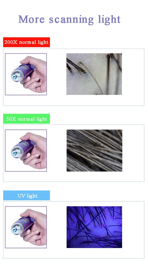 Wireless Scalp Analysis Machine Support Android And Ios System