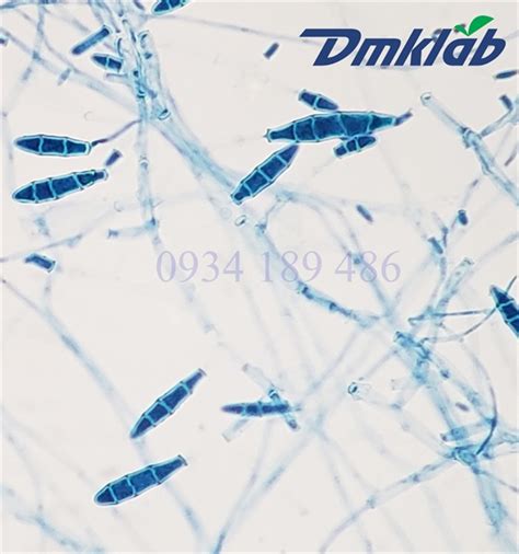 Tiêu Bản Nấm Microsporum Gypseum Edulab Việt