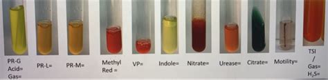 Biochemical Tests Identification Of Bacterial Isolates And Different