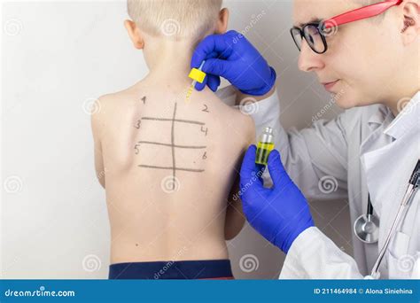 An Allergist In The Laboratory Conducts An Allergy Prick Test Skin