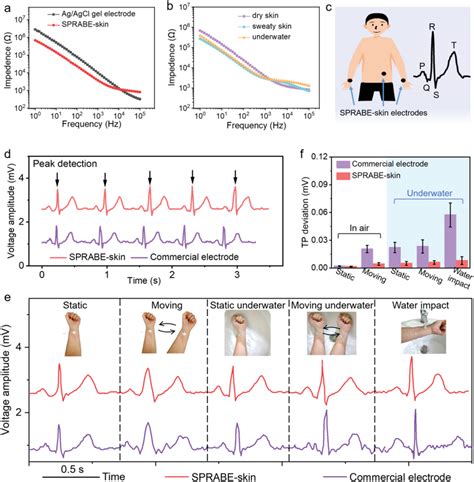 Sprabe‐skin For Ecg Measurement A Electrode‐skin Interfacial Download Scientific Diagram