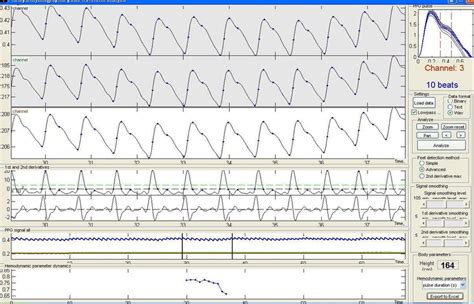 Ppg Analysis Window Screenshot During Processing Of Experimental Data