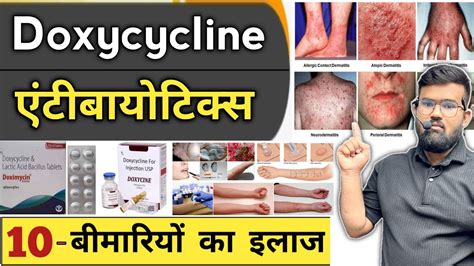 Doxycycline एंटीबायोटिक Medicine Treatment Antibiotic