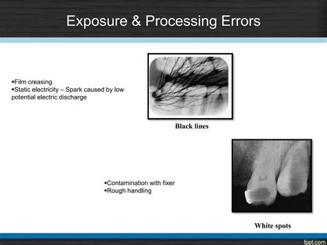 Intraoral Radiographic Processing And Faults Pptx