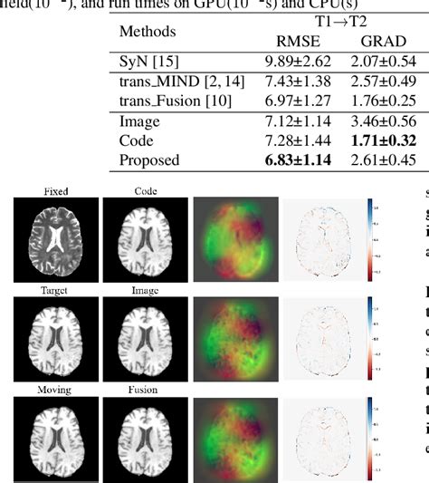 Table 1 From Fusion Based Multimodal Medical Image Registration Combining Inter Modality Metric