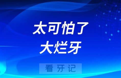 太可怕了大牙烂到这个程度必须要拔了 看牙记网