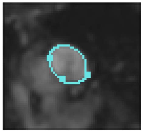 Final Result Iteration 260 With The Interpolation Conditions 3 Download Scientific Diagram