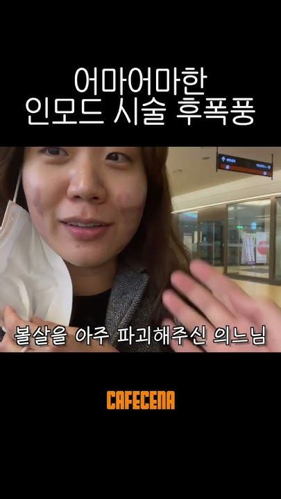 인모드 받고 깜놀하신 분들 많으실걸요 인모드 결혼준비브이로그 Youtube