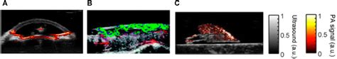 Frontiers Dual Modal Photoacoustic And Ultrasound Imaging From Preclinical To Clinical