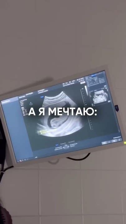 Я знаю что ты мечтаешь о беременности зачатие беременность бесплодие Shortsvideo Youtube