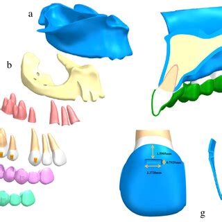 The Structure Of The Finite Element Model A Bone Cortex B Bone Download Scientific Diagram