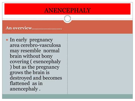 Anencephaly Pptx