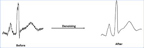 Heartbeat Ecg Signal Before And After Denoising Download Scientific Diagram