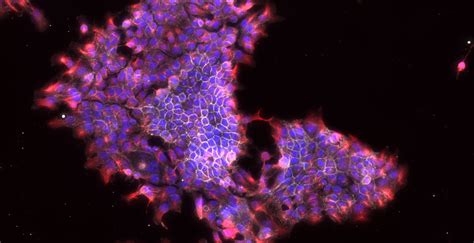 Quantifying Immunofluorescence In Whole Slides Researchgate