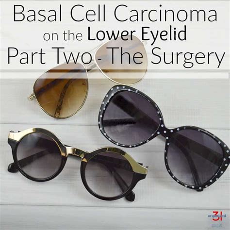 Basal Cell Carcinoma Lower Eyelid Reconstruction At Katie Eliott Blog