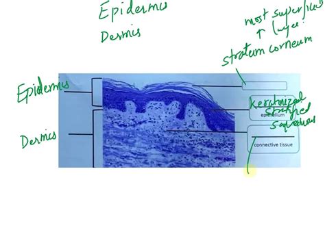 Solved Absent In Thin Skin Exercise 2 Skin Histology Label The