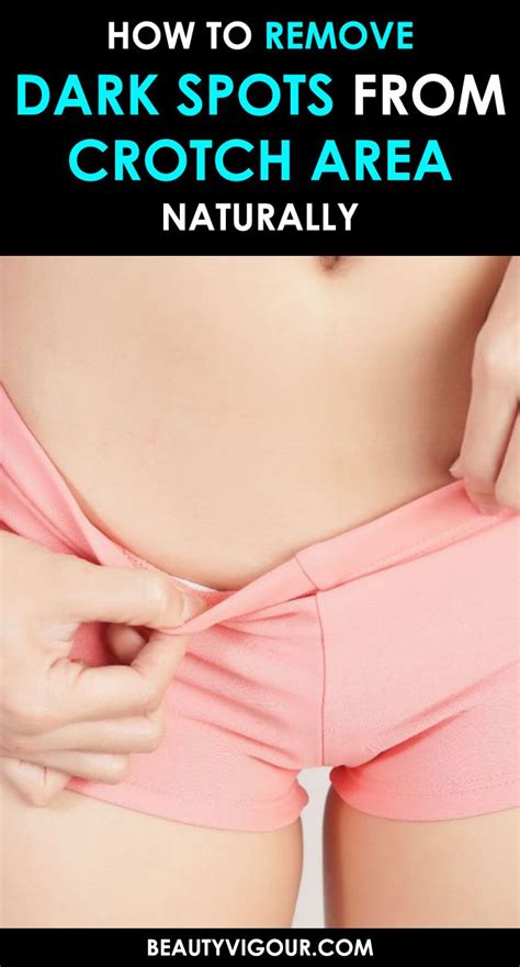 How To Remove Dark Spots From Crotch Area Remove Dark Spots How To Remove Dark Spots Dark Spots