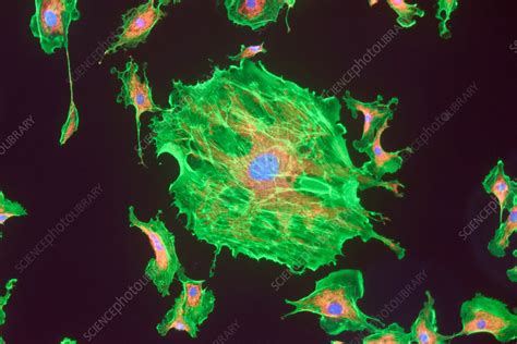 Fibroblast Cells Light Micrograph Stock Image C062 5002 Science Photo Library