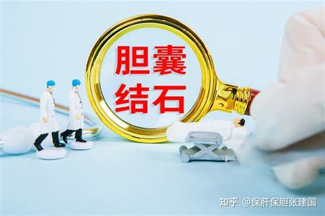 胆囊结石手术对于切胆手术保胆手术应该如何选择 知乎