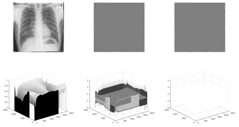 Problems Applying Matlab Filters To Dicom Images Stack Overflow