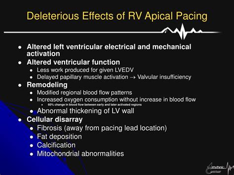 Ppt Long Term Effects Of Rv Pacing Powerpoint Presentation Free