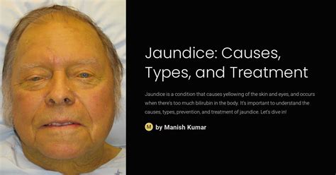 Jaundice Causes Types And Treatment