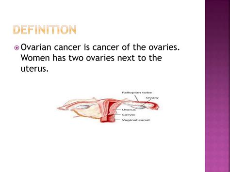 Ppt Ovarian Cancer Powerpoint Presentation Free Download Id2666442