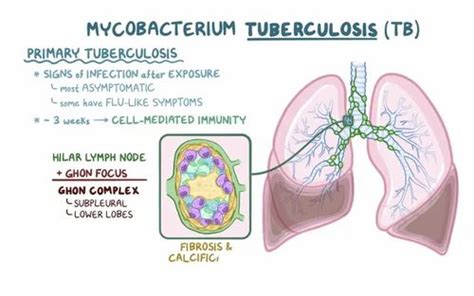 Mycobacterium Tuberculosis Complex Mtbc Detection Rt Pcr Kit At