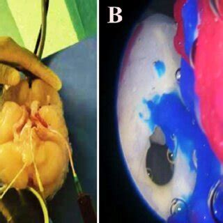 The Synthetic Dura Mater Is Wrapped Around The Silicone Brain A The Download Scientific