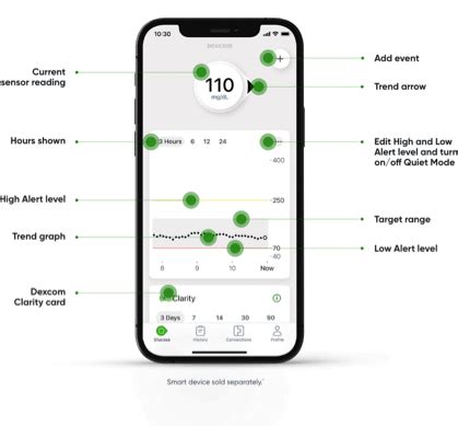 Dexcom G A Critical Review Comparison Integrated Diabetes Services