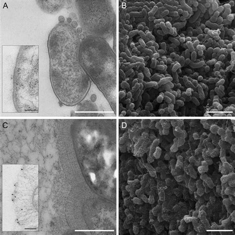 Figure 1 From Structure Of The Head Of The Bartonella Adhesin Bada