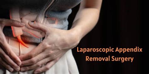 Laparoscopic Appendix Removal Surgery Dr Vishal Pawar Mumbai By Dr Vishal Pawar Medium