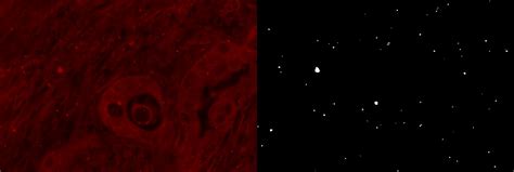 image processing how to analyze particles as beginner stack overflow