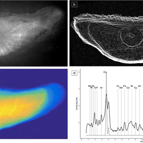 Application Of Synchrotron X Ray Fluorescence Xrf Imaging And Download Scientific Diagram