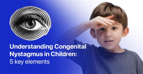 Nystagmus Vs Strabismus Expert Guide To Eye Movement Disorders