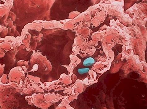 ადამიანის ორგანოების ფოტოები მიკროსკოპის ქვეშ აბა თუ გამოიცნობთ ეს რა არის