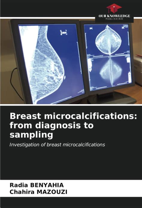 Breast Microcalcifications From Diagnosis To Sampling Investigation Of Breast