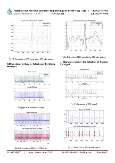 Robust System For Patient Specific Classification Of Ecg Signal Using