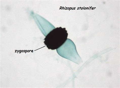 Rhizopus Conjugation Slide