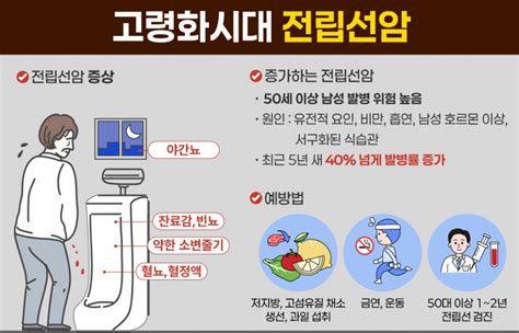 비뇨의학과 증가하는 전립선암 핵심은 정기검진 헬스코리아뉴스