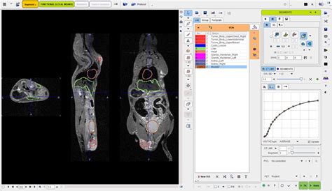 Pseg Segmentation Workflows Remote Bruker Store