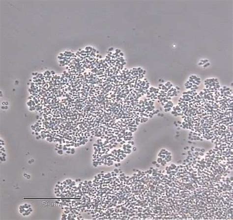 Gloeobacter Alchetron The Free Social Encyclopedia